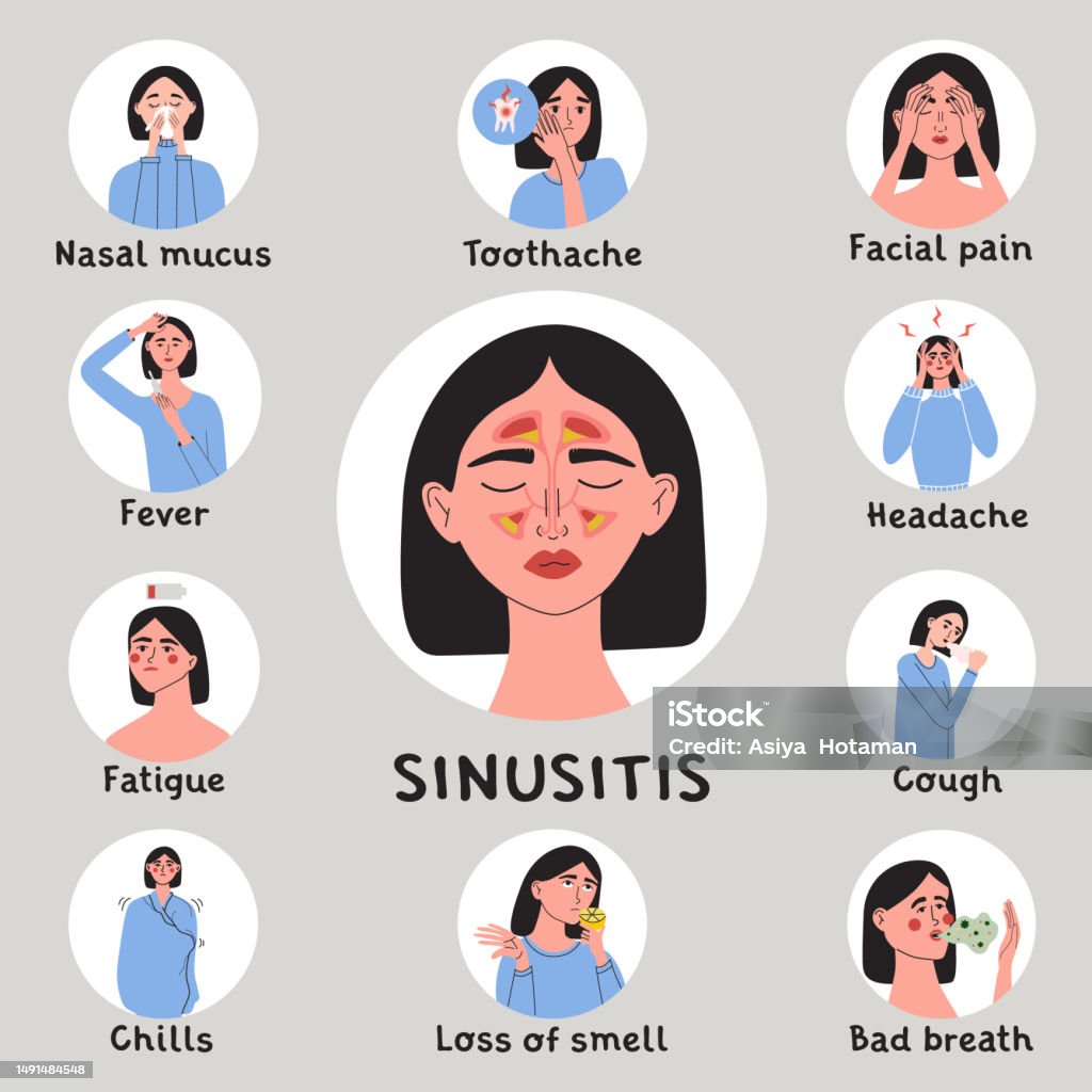 Ilustración de Mujer Joven Con Síntomas De Sinusitis Y Signos Tempranos ... Ilustración de Mujer Joven Con Síntomas De Sinusitis Y Signos Tempranos ...