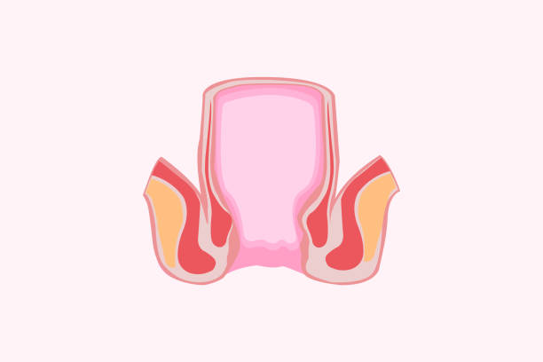 200 Cartoon Of Hemorrhoids Ilustraciones De Stock Gráficos