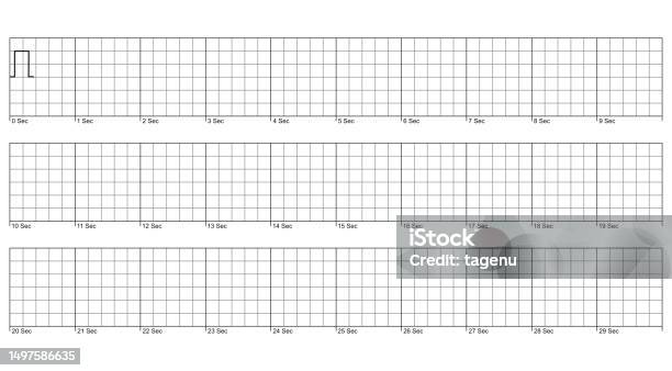 Electrocardiogram Ecg Grid Graph Ruler Grid Vector Illustration Isolated On White Background Set
