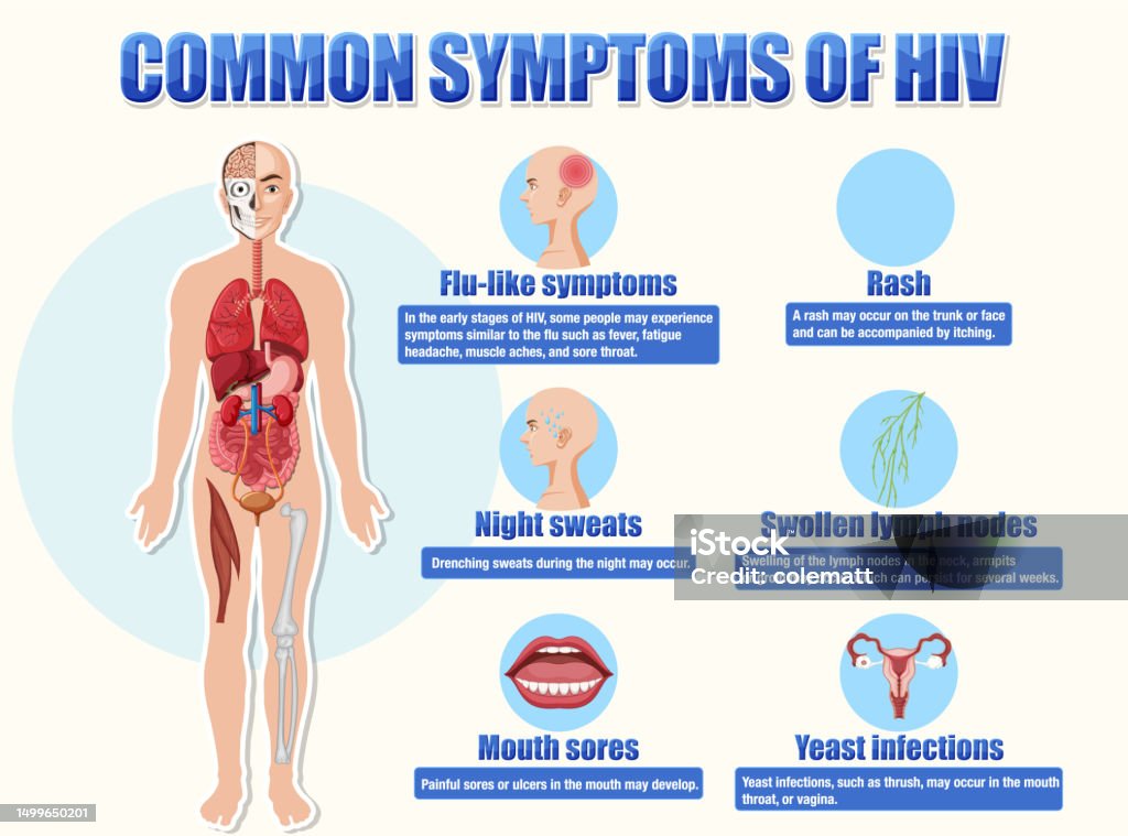 Informative Poster Of Common Symptoms Of Hiv Stock Illustration
