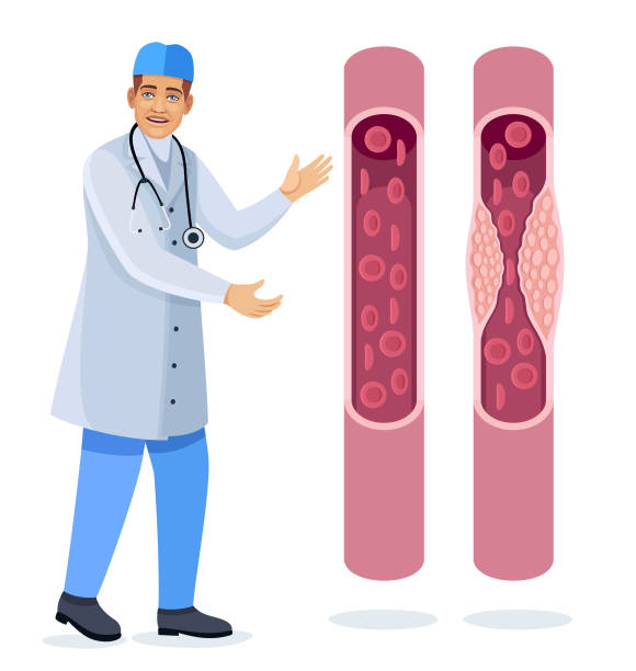 300+ High Cholesterol Levels Stock Photos, Pictures & Royalty-Free ... 300+ High Cholesterol Levels Stock Photos, Pictures & Royalty-Free ...