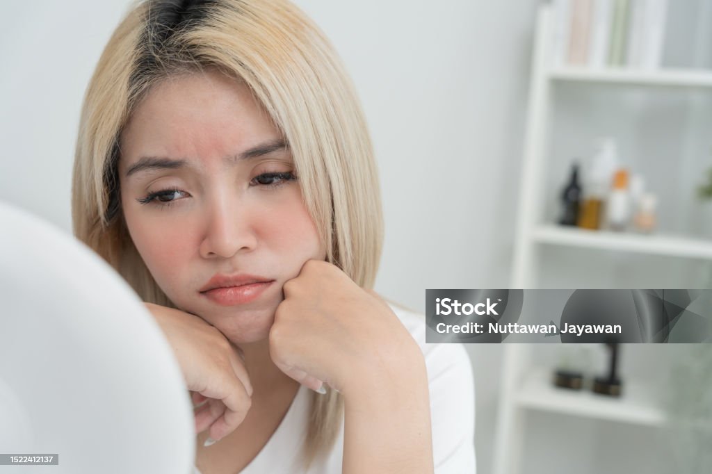 Woman Worried About Face Dermatology Rosacea Dermatitis Allergic Steroids Sensitive Skin Red