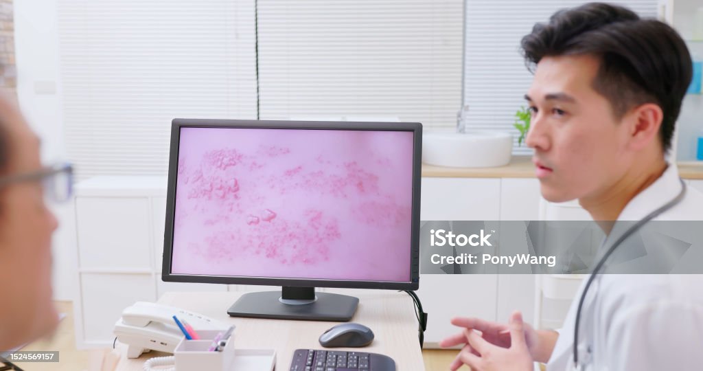 Foto De Médico Explica Doença De Herpeszóster E Mais Fotos De Stock De