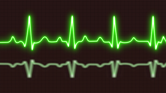 Cardiogramme Cardiographe Oscilloscope Écran Vert Ligne De Moniteur