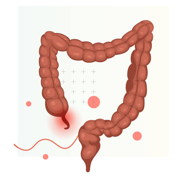 110 Anus Close Up Stock Illustrations Royalty Free Vector Graphics And Clip Art Istock