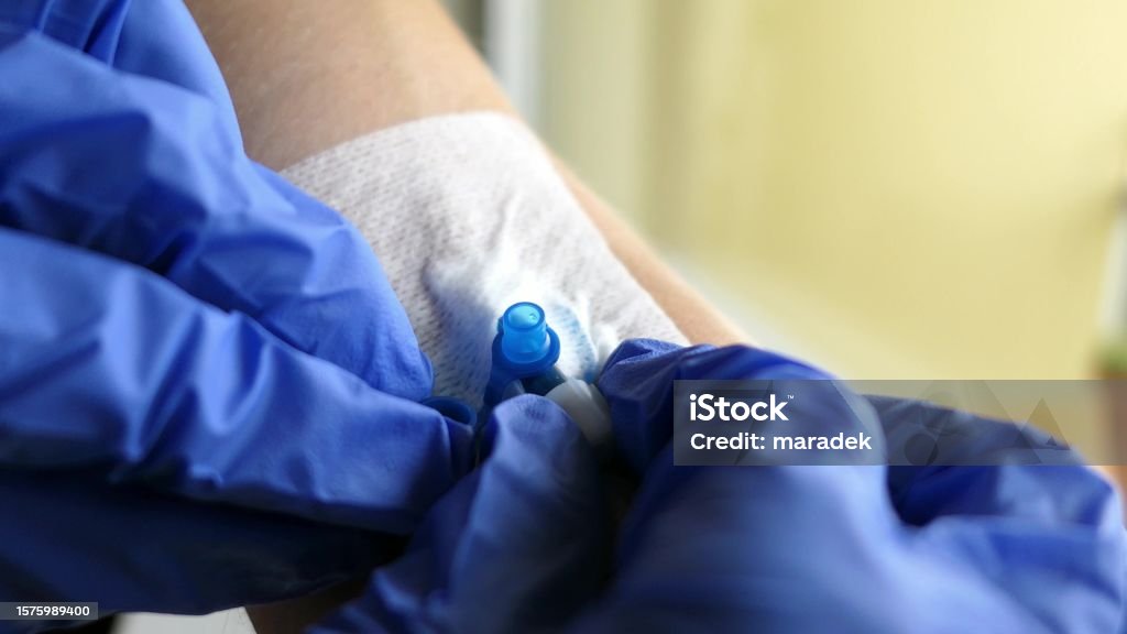 Nurse Inserting Intravenous Catheter Into Patients Arm Stock Photo ... Nurse Inserting Intravenous Catheter Into Patients Arm Stock Photo ...