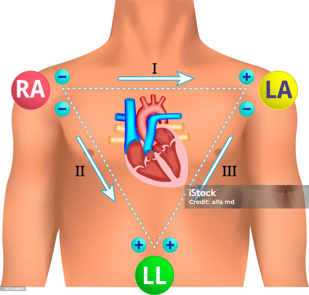 Standard Limb Leads Ecg Einthoven Triangle Electrocardiogram Lead ... Standard Limb Leads Ecg Einthoven Triangle Electrocardiogram Lead ...