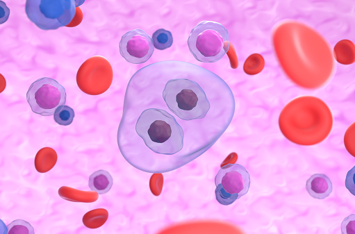 Reedsternberg Cell In Hodgkin Lymphoma Isometric View 3d Render