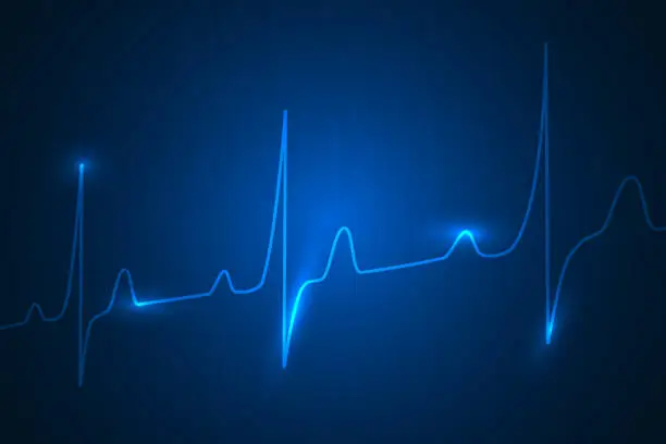 Free normal ecg graph illustrations | Download free stock images ... Free normal ecg graph illustrations | Download free stock images ...