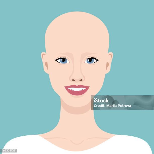 Young Smiling Woman With Alopecia Beautiful Bald Girl Alopecia Areata