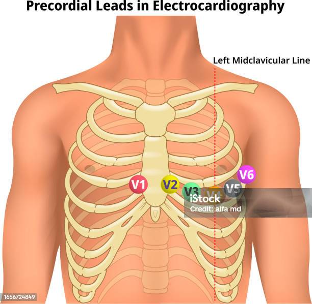 Precordial Leads In Electrocardiography V1 V2 V3 V4 V5 And V6 Position ... Precordial Leads In Electrocardiography V1 V2 V3 V4 V5 And V6 Position ...