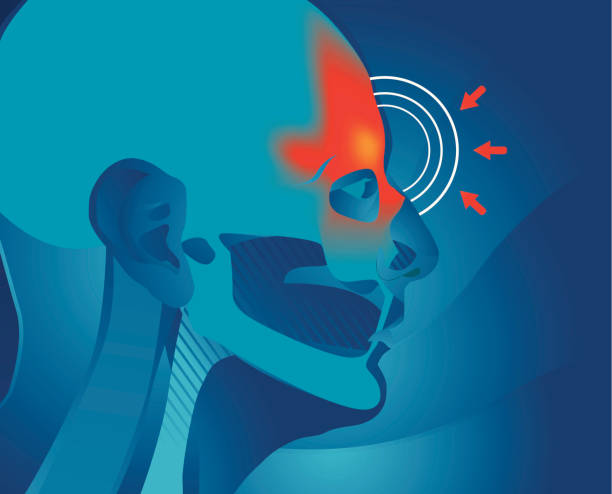 8 900 Sinusitis Ilustraciones Fotografías De Stock Fotos E Imágenes