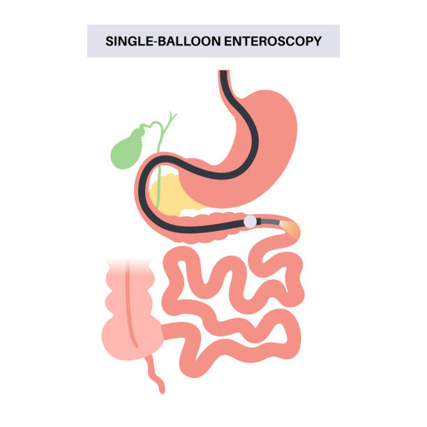 10+ Squeeze Balloon Stock Illustrations, Royalty-Free Vector Graphics ... 10+ Squeeze Balloon Stock Illustrations, Royalty-Free Vector Graphics ...