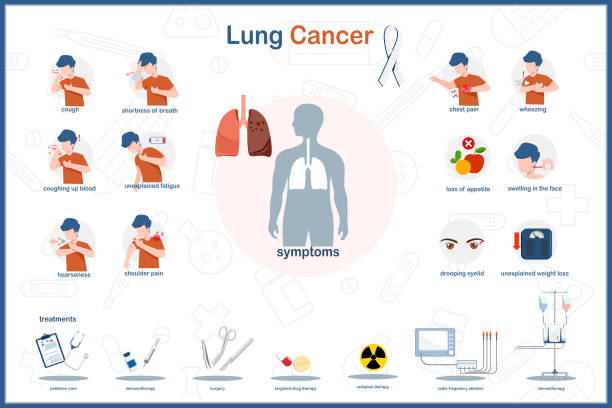 250+ Chemotherapy Immunotherapy Stock Illustrations, Royalty-Free ... 250+ Chemotherapy Immunotherapy Stock Illustrations, Royalty-Free ...