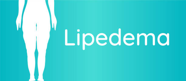 150 Edema Background Stock Illustrations Royalty Free Vector Graphics