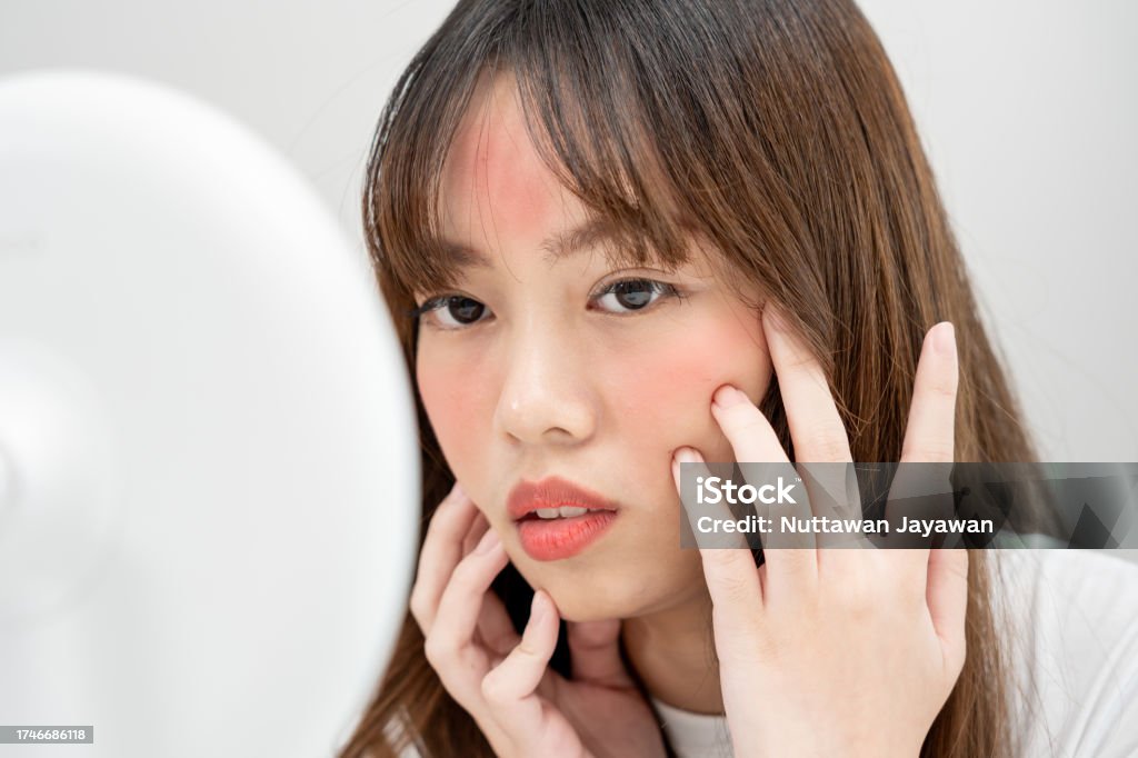 Woman Worried About Face Dermatology Rosacea Dermatitis Allergic Steroids Sensitive Skin Red