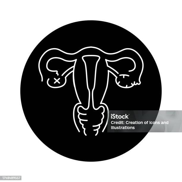 Ilustración De Icono De Línea De Color Del Mioma Uterino Problema