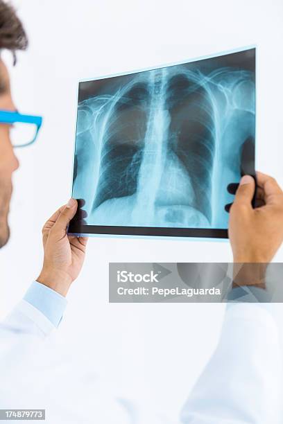 Dokter Memeriksa Xray Paruparu Foto Stok Unduh Gambar Sekarang 30