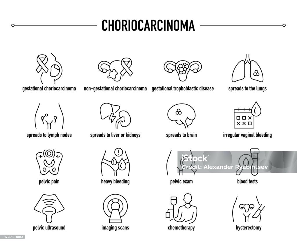 Choriocarcinoma Symptoms Diagnostic And Treatment Vector Icons Stock Illustration Download