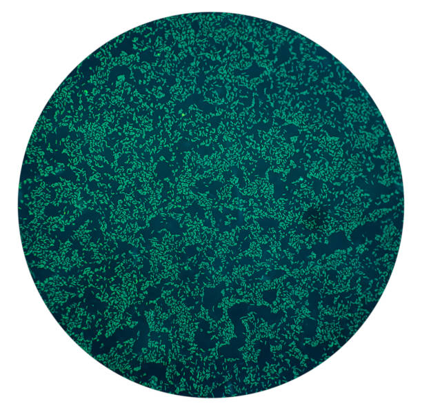 Free picture: clostridium botulinum, spores, malachite, green, stain