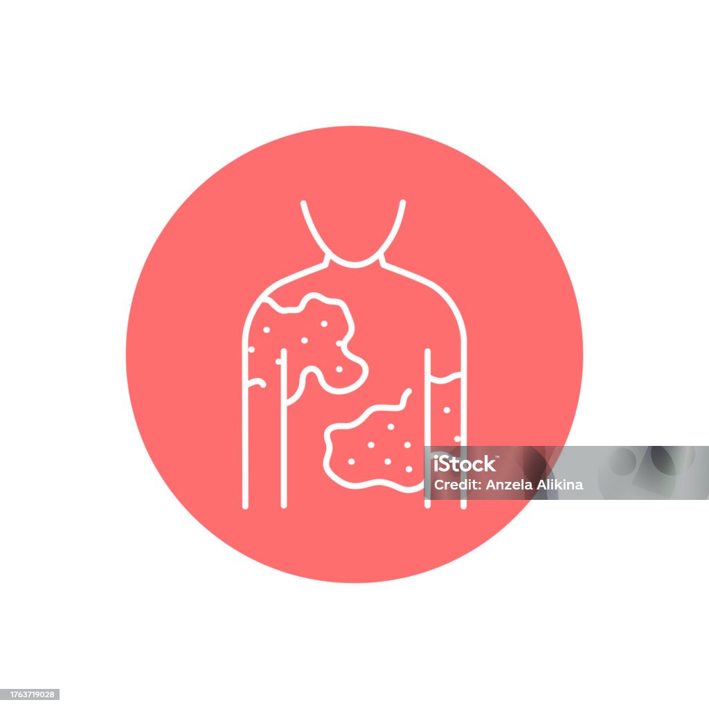 Urticaria Black Line Icon Dermatology Disease Stock Illustration