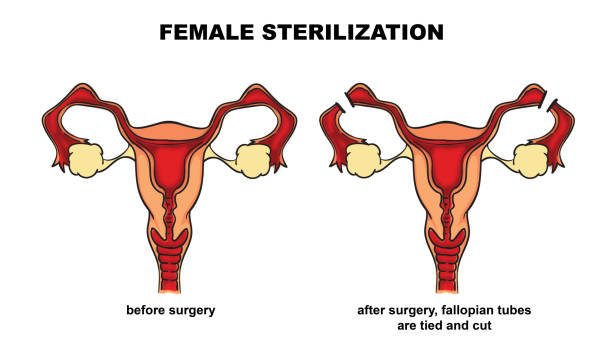 60 Pap Smear Doctor Stock Illustrations Royalty Free Vector Graphics