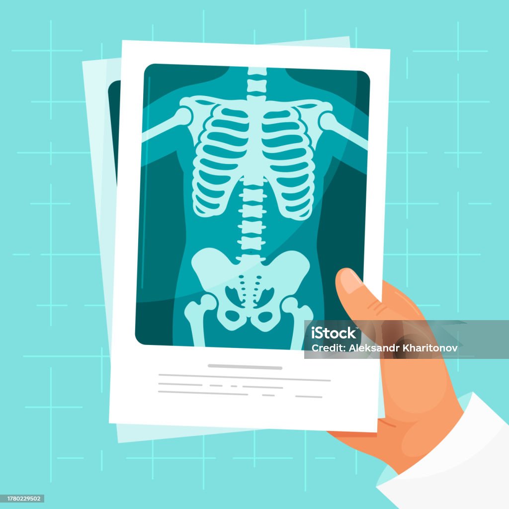 Gambar Diagnostik Kerangka Tubuh Manusia Rontgen Medis Sinarx Pada ... Gambar Diagnostik Kerangka Tubuh Manusia Rontgen Medis Sinarx Pada ...