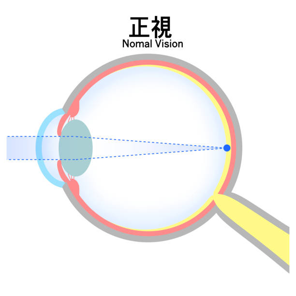 210+ Lateral Eye Stock Illustrations, Royalty-Free Vector Graphics ... 210+ Lateral Eye Stock Illustrations, Royalty-Free Vector Graphics ...