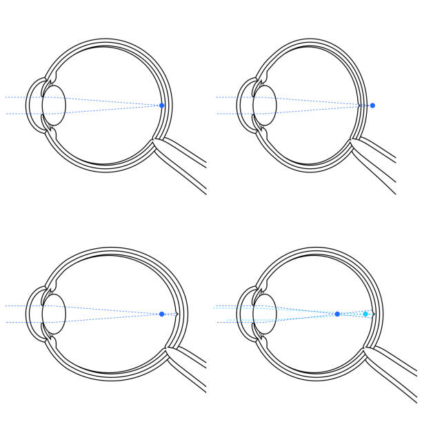 210+ Lateral Eye Stock Illustrations, Royalty-Free Vector Graphics ... 210+ Lateral Eye Stock Illustrations, Royalty-Free Vector Graphics ...