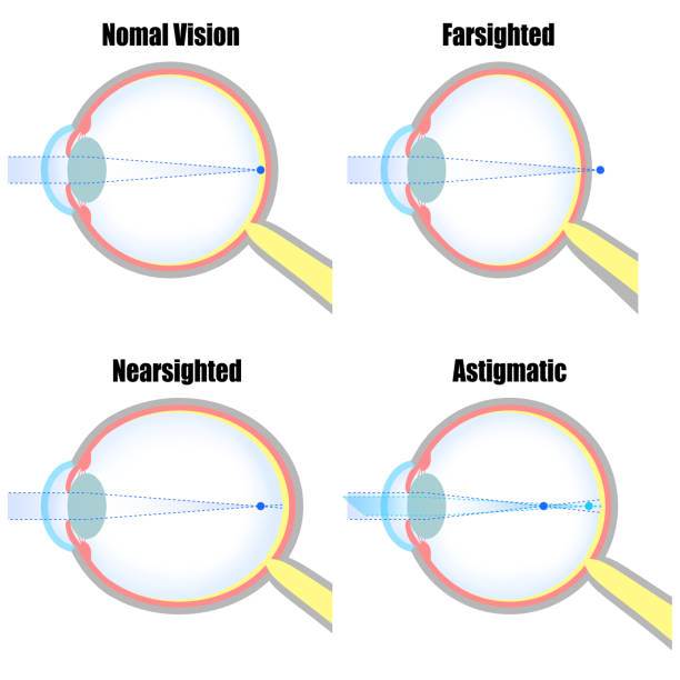 210+ Lateral Eye Stock Illustrations, Royalty-Free Vector Graphics ... 210+ Lateral Eye Stock Illustrations, Royalty-Free Vector Graphics ...
