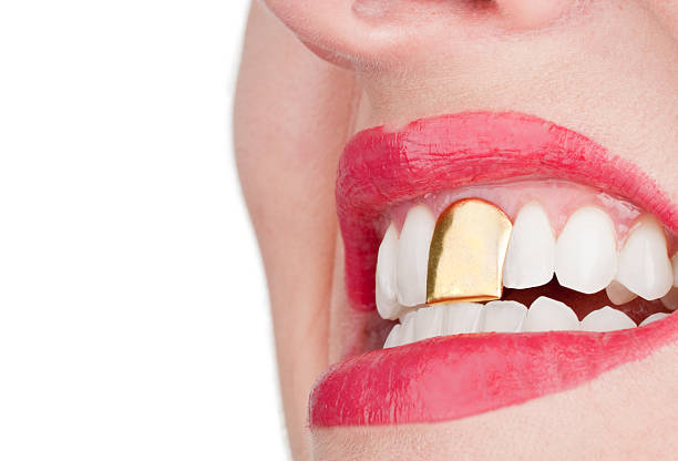Gold Teeth Pictures | Download Free Images on Unsplash