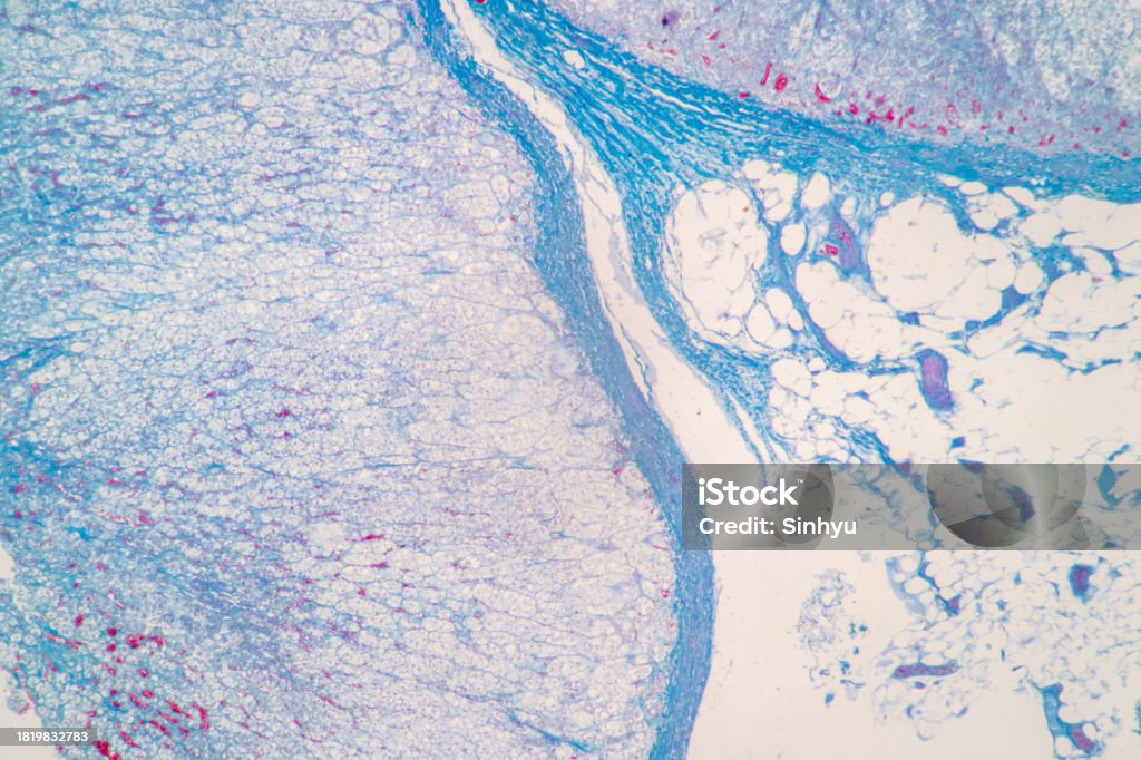 Showing Light Micrograph Of The Adrenal Gland Human Under The