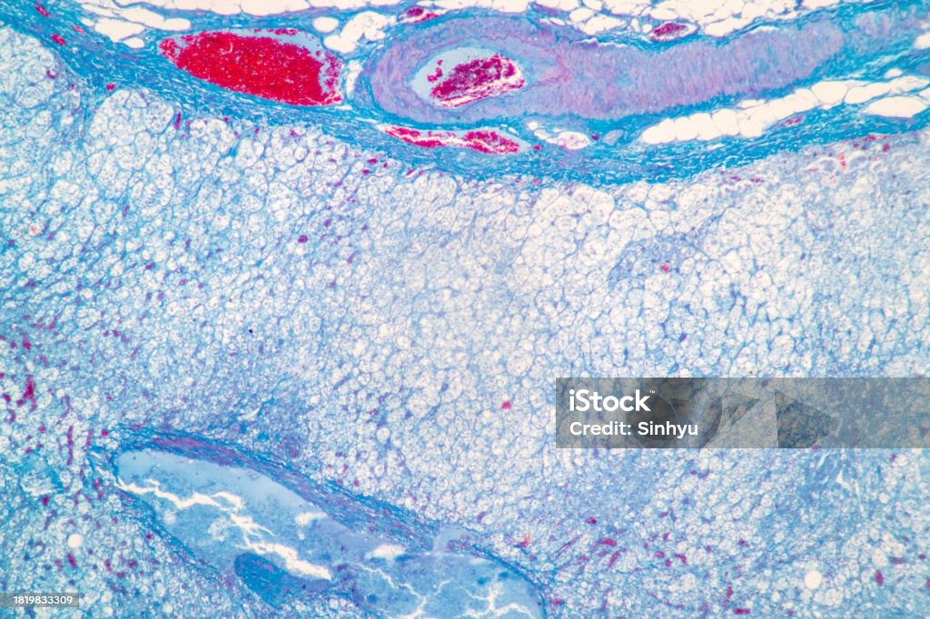 Showing Light Micrograph Of The Adrenal Gland Human Under The