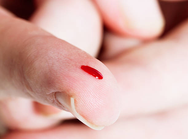 30,000+ Blood Finger Pictures | Download Free Images on Unsplash
