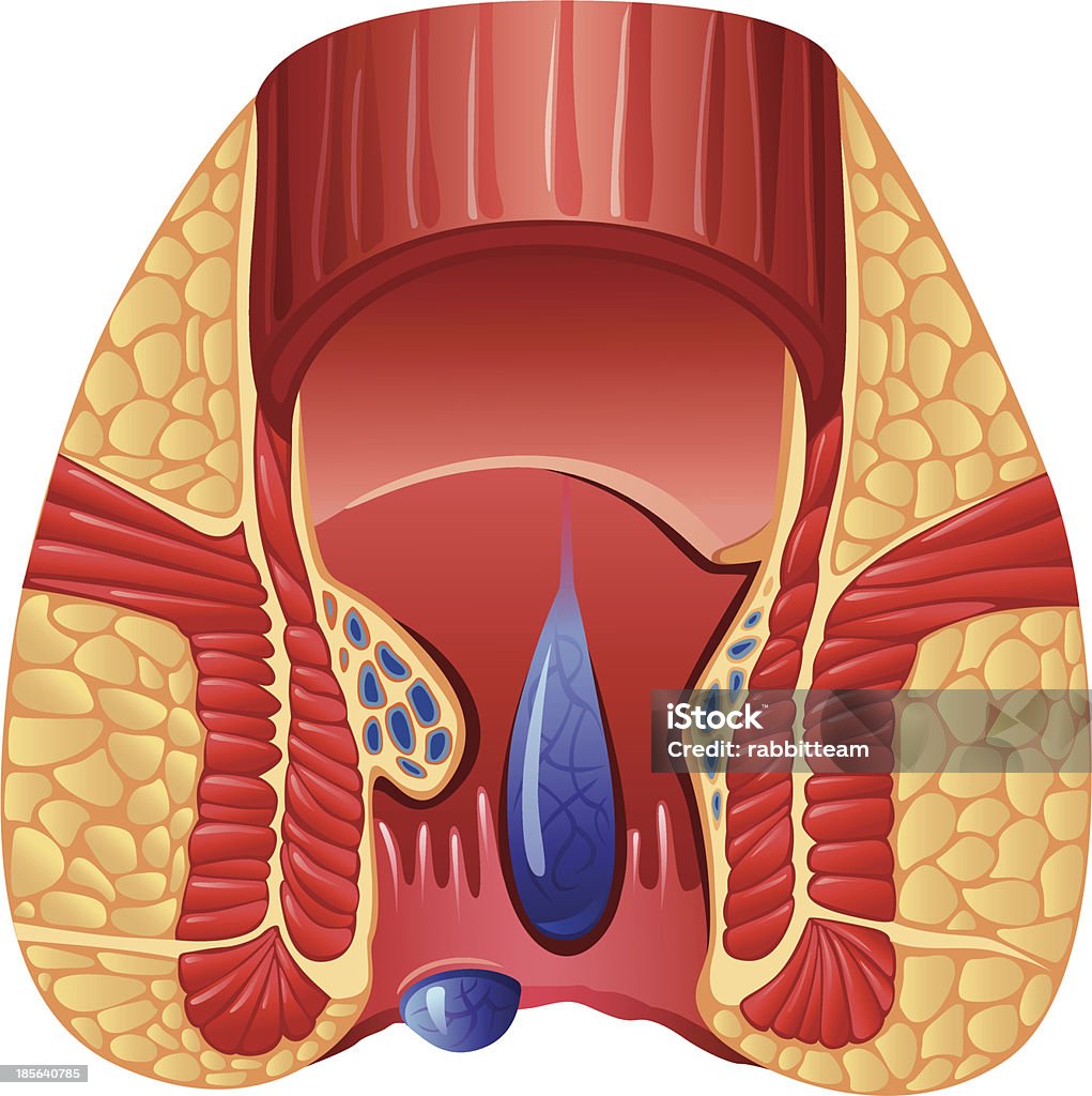 Hemorrhoid Stock Illustration Download Image Now Anatomy