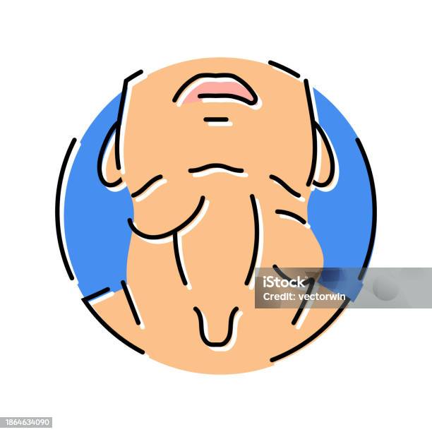 Swollen Lymph Nodes Disease Symptom Color Icon Vector Illustration ... Swollen Lymph Nodes Disease Symptom Color Icon Vector Illustration ...