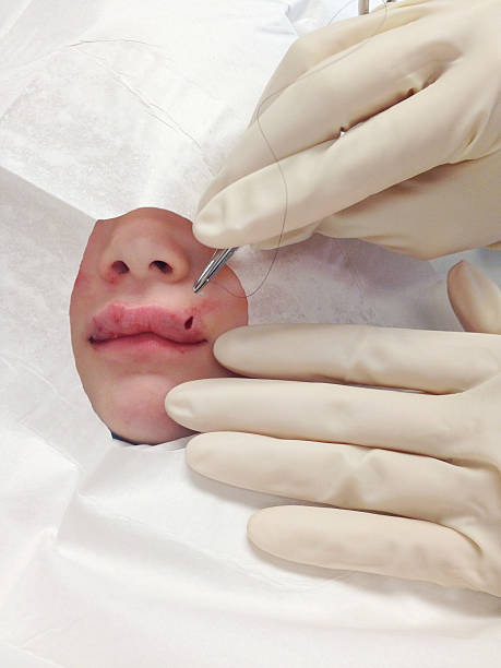 90+ Stitches Child Wound Laceration Stock Photos, Pictures & Royalty ... 90+ Stitches Child Wound Laceration Stock Photos, Pictures & Royalty ...