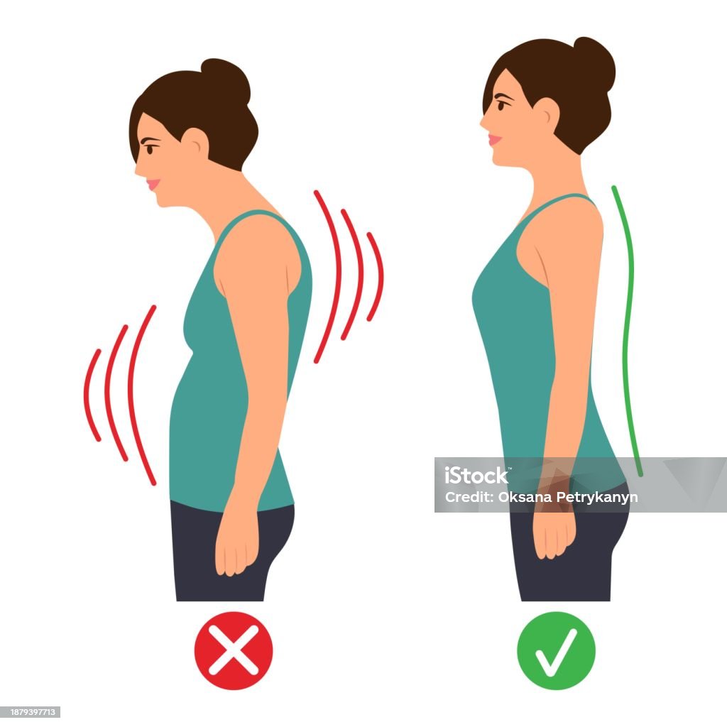 Correct And Incorrect Standing Posture Stock Illustration Download