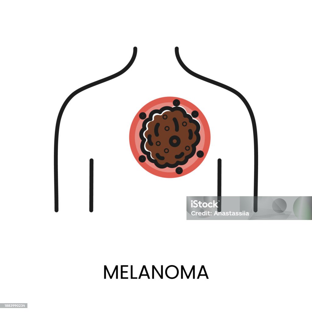 Skin Cancer Melanoma Line Icon Vector Cancer Malignant Disease Stock