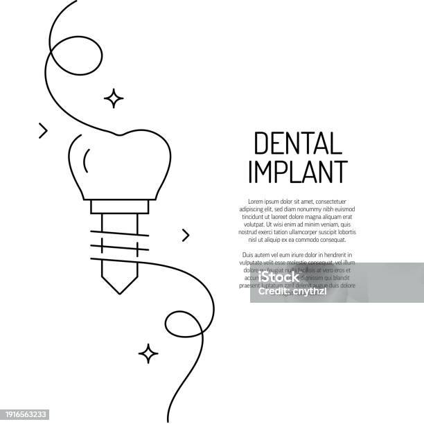 Gambar Garis Kontinu Ikon Implan Gigi Ilustrasi Vektor Simbol Yang ... Gambar Garis Kontinu Ikon Implan Gigi Ilustrasi Vektor Simbol Yang ...