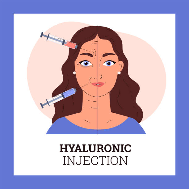 50 Cheek Injections Stock Illustrations Royalty Free Vector Graphics