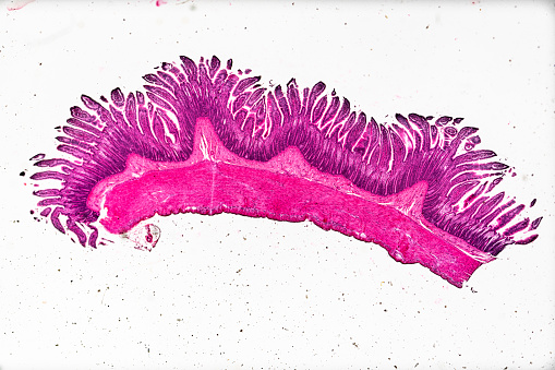 Muestra Histológica Epitelio Columnar Simple Sec Bajo Microscopía ... Muestra Histológica Epitelio Columnar Simple Sec Bajo Microscopía ...
