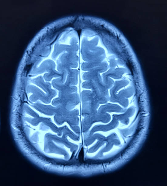 14.600+ Pemindai Mri Foto Foto Foto Stok, Potret, & Gambar Bebas ... 14.600+ Pemindai Mri Foto Foto Foto Stok, Potret, & Gambar Bebas ...