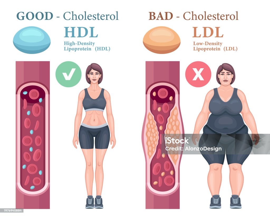 Types Of Cholesterol In The Blood Concept Highdensity Lipoprotein Stock ... Types Of Cholesterol In The Blood Concept Highdensity Lipoprotein Stock ...