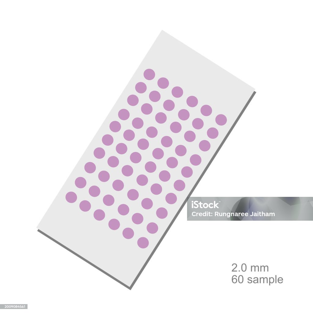 The Sample Slide Of Tissue Microarray Technique Was Staining For Target