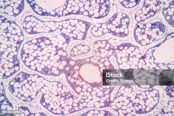 Anatomía E Histología De La Médula Ósea Roja Humana Y Tendinosa Humana
