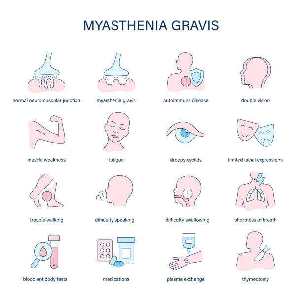 40+ Myasthenia Gravis Stock Illustrations, Royalty-Free Vector Graphics ... 40+ Myasthenia Gravis Stock Illustrations, Royalty-Free Vector Graphics ...