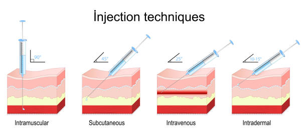 Subcutaneous Injection Mastering Subcutaneous Injections: A Subcutaneous Injection Mastering Subcutaneous Injections: A