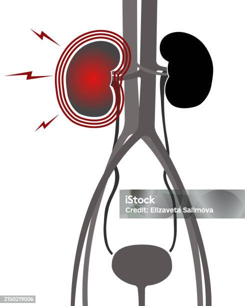 Urinary System Kidneys Bladder Ureters Stock Illustration - Download ... Urinary System Kidneys Bladder Ureters Stock Illustration - Download ...