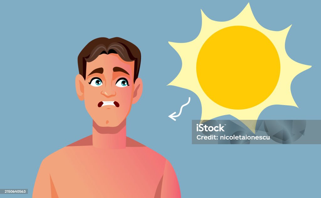 Man Getting Sunburns From Heated Sun Vector Cartoon Illustration Stock